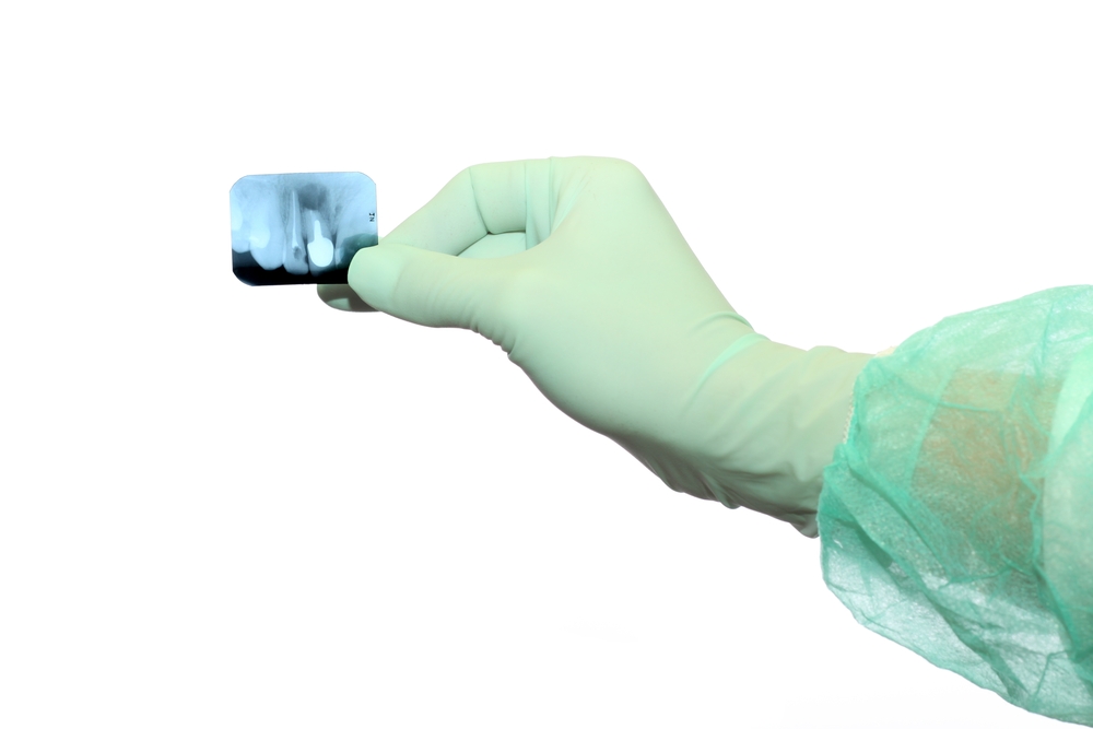 Retrograde root filling: insufficient evidence for best material ...