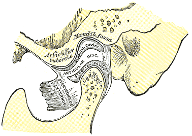 Intra-articular injection for temporomandibular joint arthralgia ...