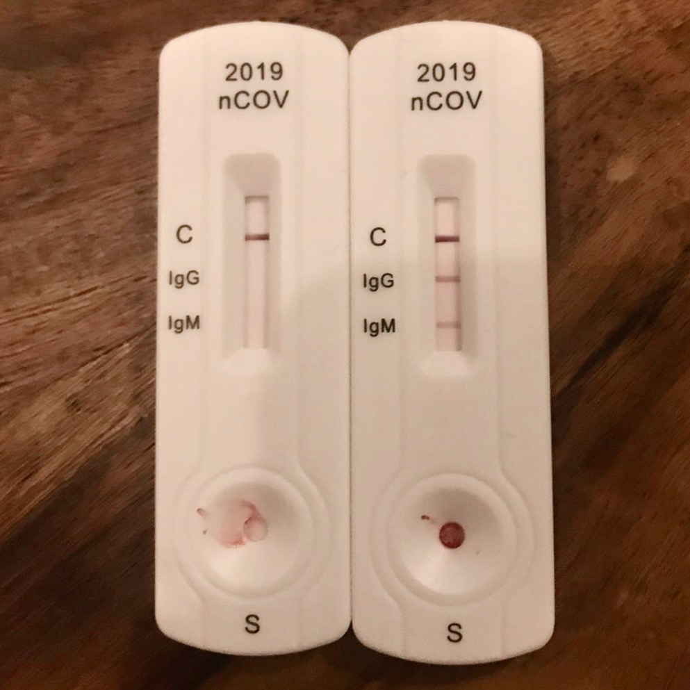 Dentistry Diagnostic Test Accuracy DTA And The Covid 19 Antibody