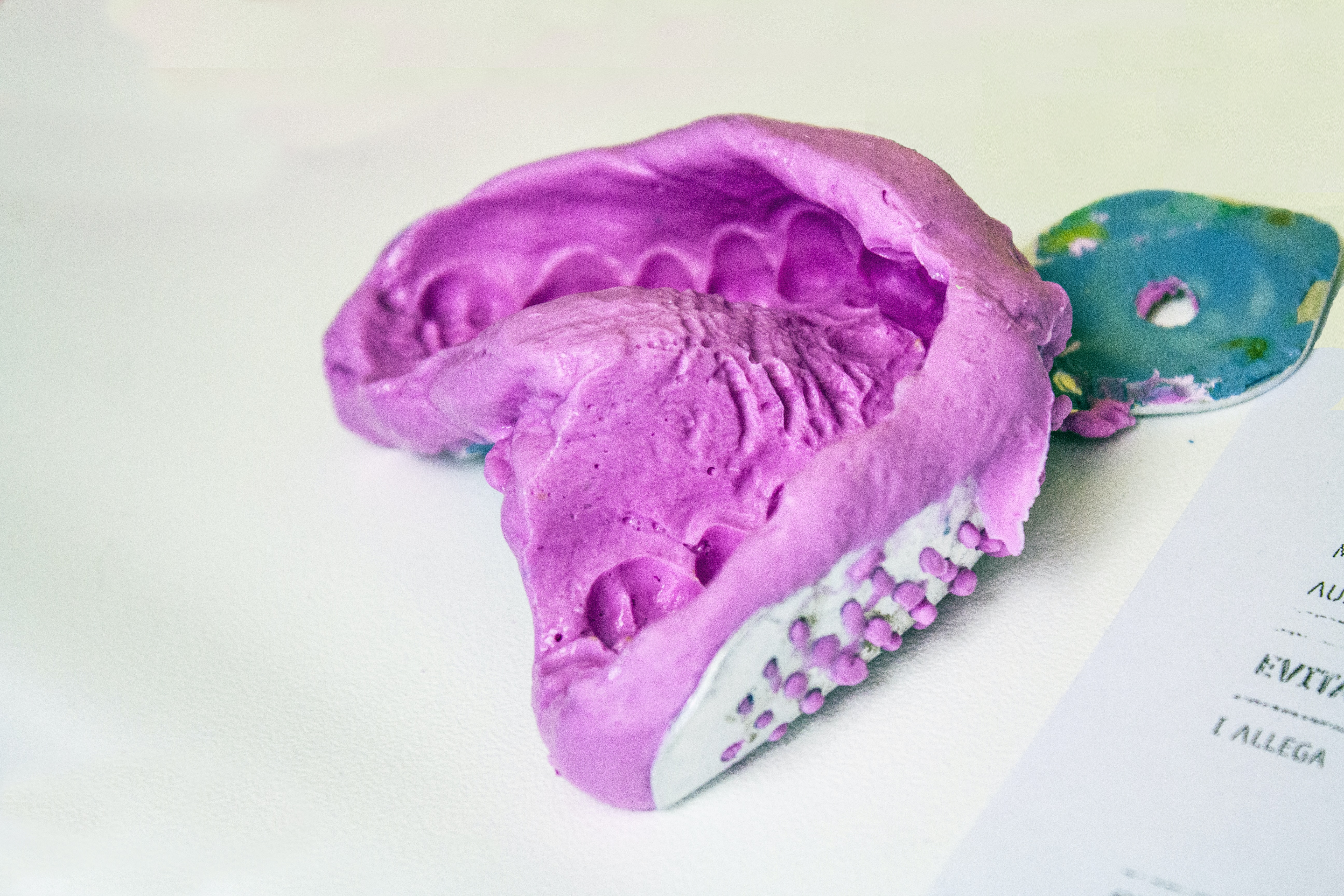 Intraoral scanning v conventional impressions – patient related ...